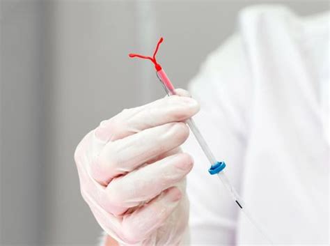 Ketahui Prosedur Pemasangan IUD atau KB Spiral pada Perempuan
