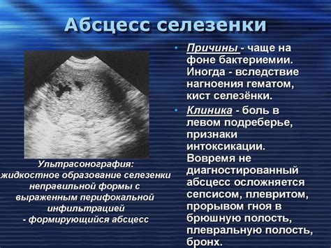 Хирургические заболевания селезенки - презентация онлайн