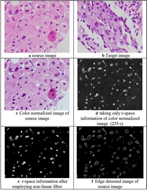 Color Normalization And Edge Detection Of Histopathology Image