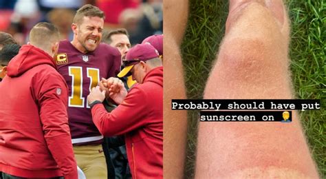 Everyone Said The Same Thing About New Image Of Alex Smiths Surgically