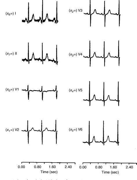 Figure 34 From Compression Of Digital Biomedical Signals Semantic Scholar
