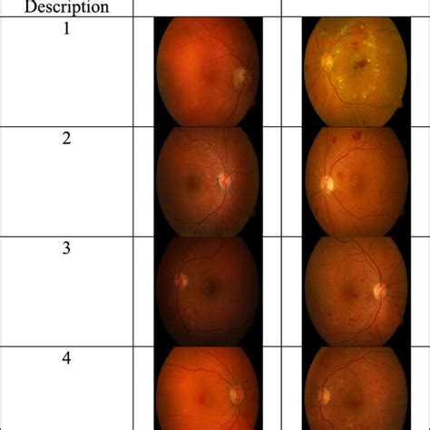 Confusion Matrix Using The S Ddl Algorithm On The Octid Dataset For
