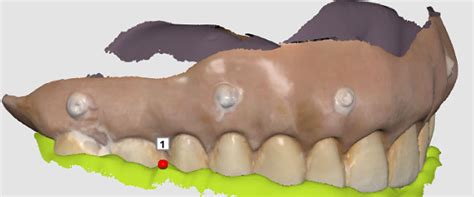 Denture Scan Strategy Medit Help Center
