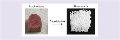 Development Of A Decellularized Porcine Bone Matrix For Potential Applications In Bone Tissue