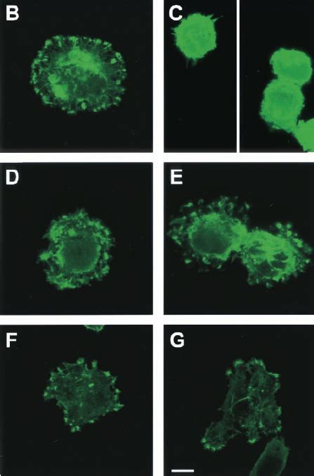 Tat Merlin Isoform 1 Speci Fi Cally Reverses Schwannoma Cell Membrane