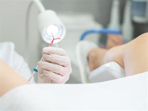 What To Expect During IUD Insertion YEG Thrive