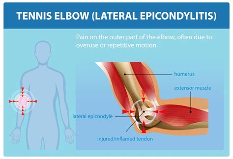 Images De Anatomie Du Coude Téléchargement Gratuit Sur Freepik