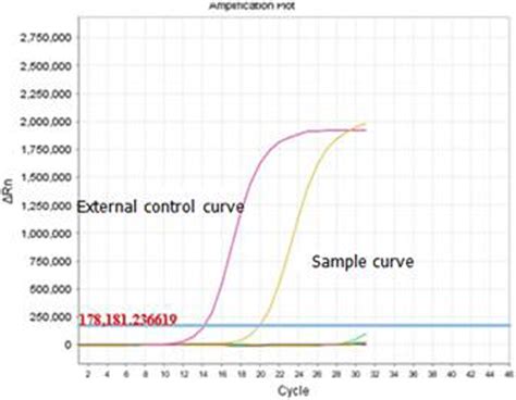 Egfr Gene Analysis Of The Left Lung Lesion Revealed An L858r Mutation Download Scientific