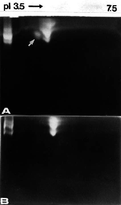Separation Of Purified Aspartic Proteinases By Two Dimensional Download Scientific Diagram