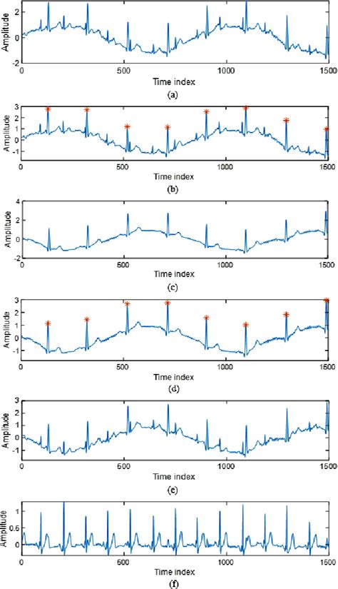 Figure 6 From Impact Of Linearization In Abdominal Ecg For Non Causal