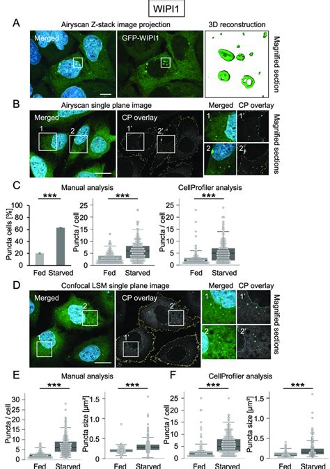 gfp wipi1 puncta analysis by manual counting and cellprofiler based download scientific diagram