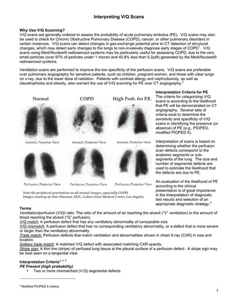 Can A Vq Scan Detect Lung Cancer Cancerwalls