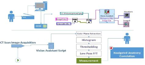 CT Scan Data Processing Approach For Brain Tumor Detection Download Scientific Diagram