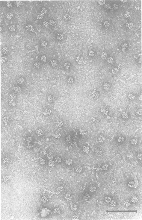 micrograph of a negatively stained field of rosettes showing the