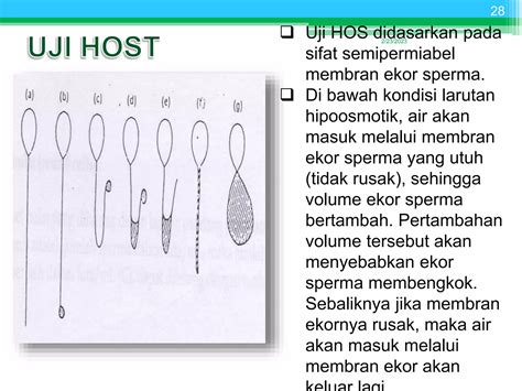 Sperm Analysis WHO Pptx