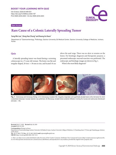 Pdf Rare Cause Of A Colonic Laterally Spreading Tumor