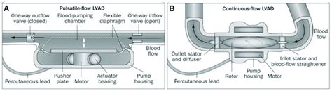 Critical Care Device Series Lvads Emra