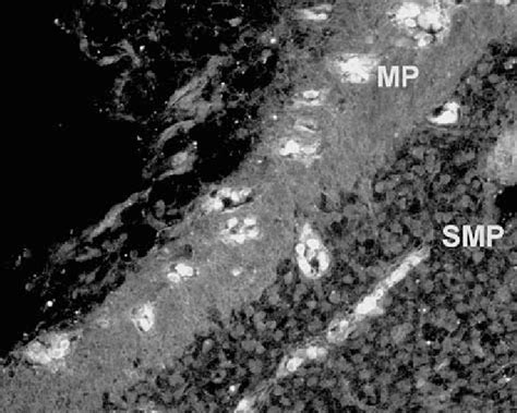 Pgp Staining Pattern In The 9th Wog The Myentericus Plexus Mp And