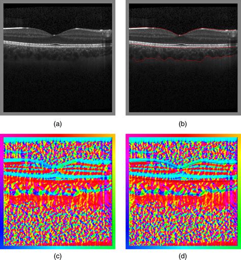 automated detection of the choroid boundary within oct image data using