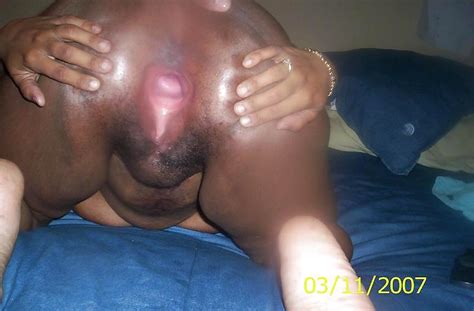 Gaping Hole Porn Pictures Xxx Photos Sex Images Pictoa