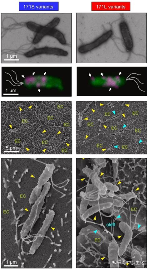 《细胞》子刊：“剧毒”幽门螺杆菌现身！科学家首次发现一种让幽门螺杆菌钻得更深、变得更毒的变异，与胃癌显著相关 知乎