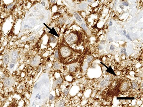 Synaptophysin Strongly Labels The Fibrillary Background In Addition To Download Scientific