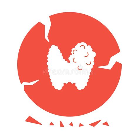 Thyroid Gland With Goiter Disease Awareness Poster Stock Vector