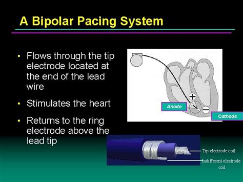 Basics Of Pacemaker Functioning T K Govindarajan Medtronic