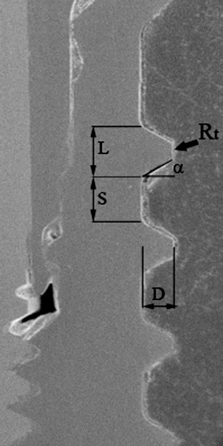 Sem Image For Definition Of The Titanium Dental Implant Thread Design