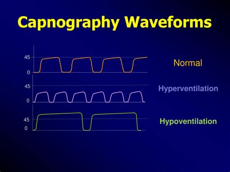 Waveform Capnography Tracheal Intubation At Dale Mack Blog