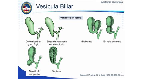Variantes Anatómicas Y Anatomía Quirúrgica De Las Vías Biliares Youtube