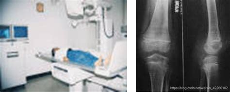 数字图像处理概述ppt学习1数字图像处理发展技术ppt关关雎鸠儿的博客 Csdn博客