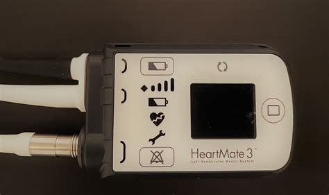 What Is The Pulsatility Index Criticalcarenow