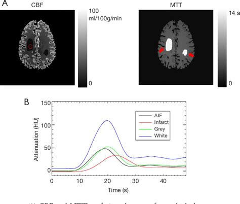 Figure From Inferring CT Perfusion Parameters And Uncertainties Using