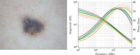melanoma detection with electrical impedance spectroscopy and dermoscopy using joint deep