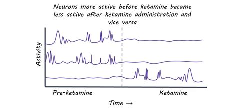Understanding Ketamine Induced Dissociation — Brainpost Easy To Read