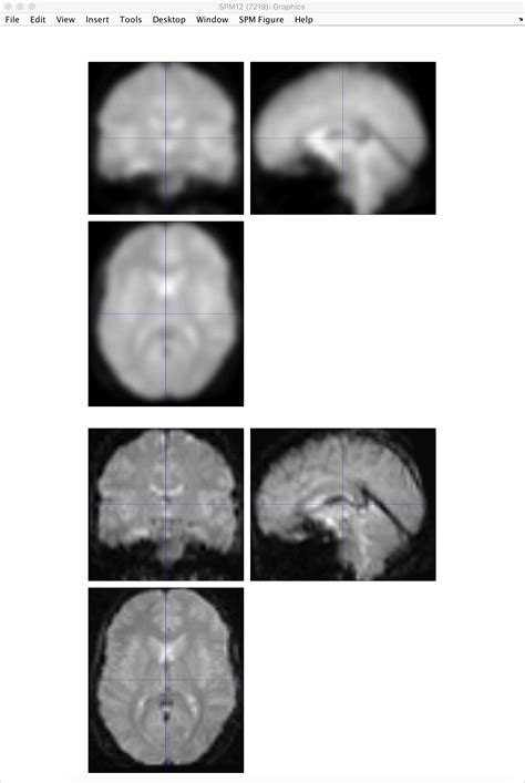 Chapter Smoothing Andy S Brain Book Documentation