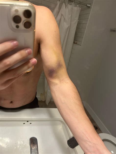 Donating Plasma Side Effects Rplassing