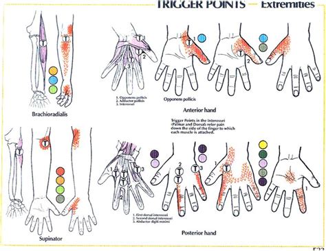1000 Images About Trigger Point On Pinterest