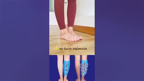 Здоровье начинается со стоп🦶 больвколенях осанка отеки плоскостопие Youtube