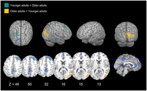 Age Differences In Successful Intentional Forgetting Areas That Are