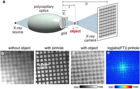 X Ray Grid Ratio Formula At Jared Harper Blog