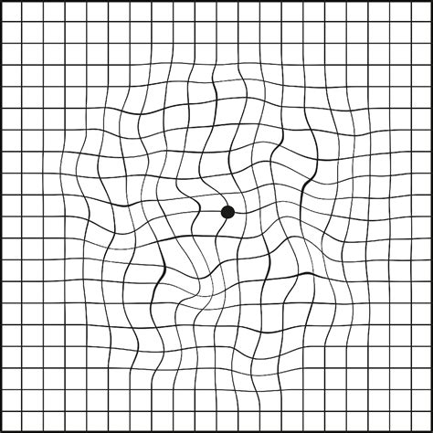 Amd Self Test Promacula®