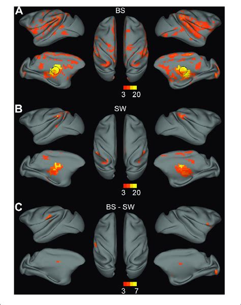 Altered Functional Connections Across Anesthesia Levels In