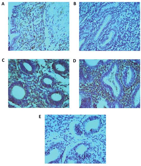 Expression Of SSTR Subtypes In Normal Endometrial Tissues Download Scientific Diagram