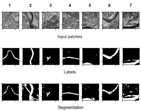 Test Samples Segmentation Performed By The Best Model Download
