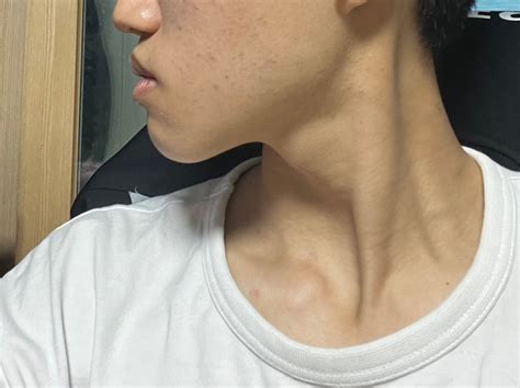 입술옆 착색 검은색 뭔가요 지식in