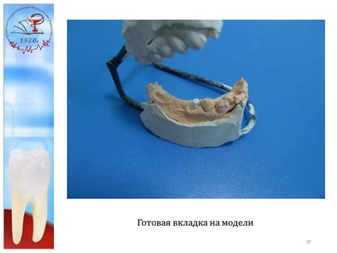 Ортопедическое лечение тотальных дефектов тканей коронок зубов. Виды ...