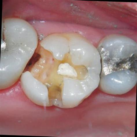 Thesis Yolov11 Object Detection Dataset By Test