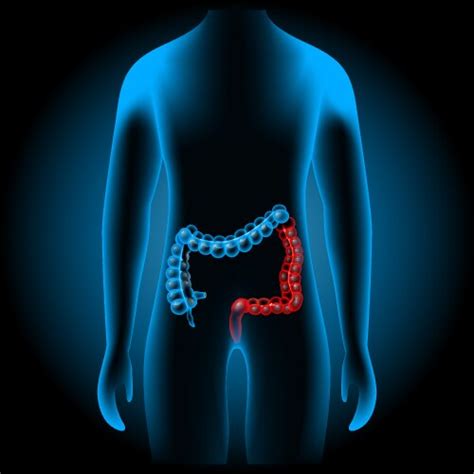 Inflammatory Bowel Disease Vector Images Over 140